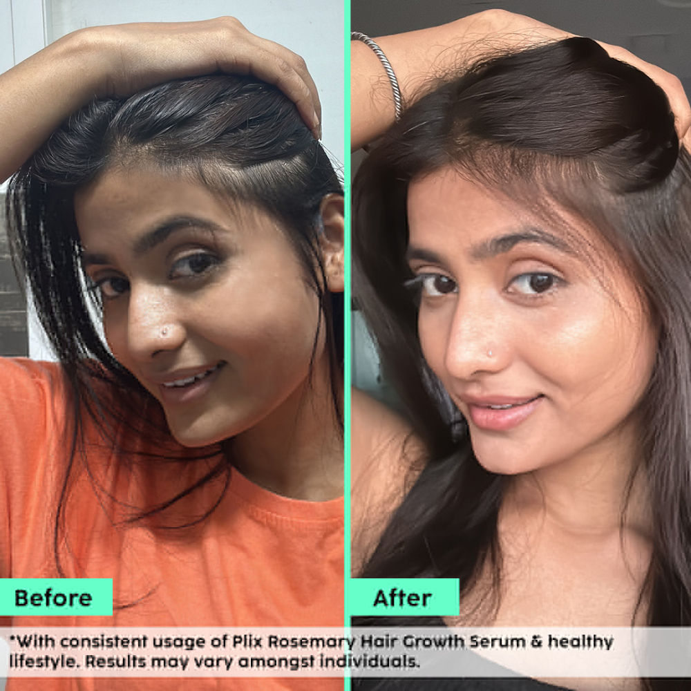 Buy Plix Rosemary Hair Growth Serum Online