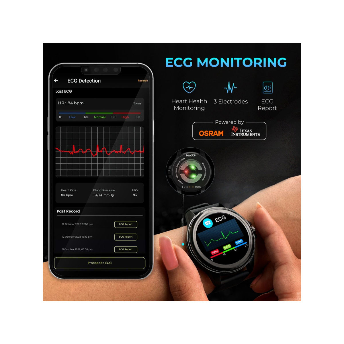 beatXP Exact, 1.32" Full HD Screen, Medical Grade ECG & Health ...