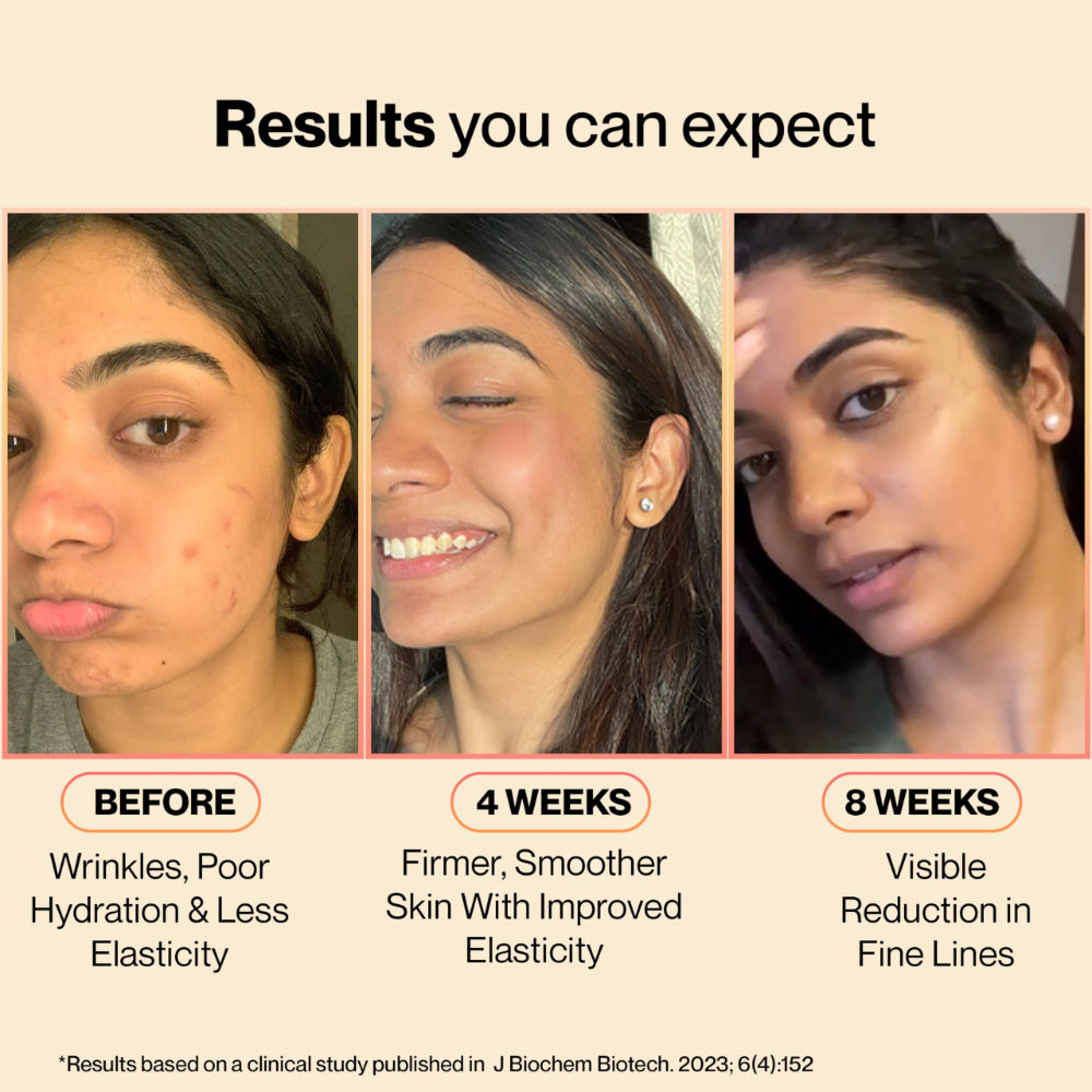 Buy Setu Skin Youthful Marine Collagen Powder with Biotin for Women ...