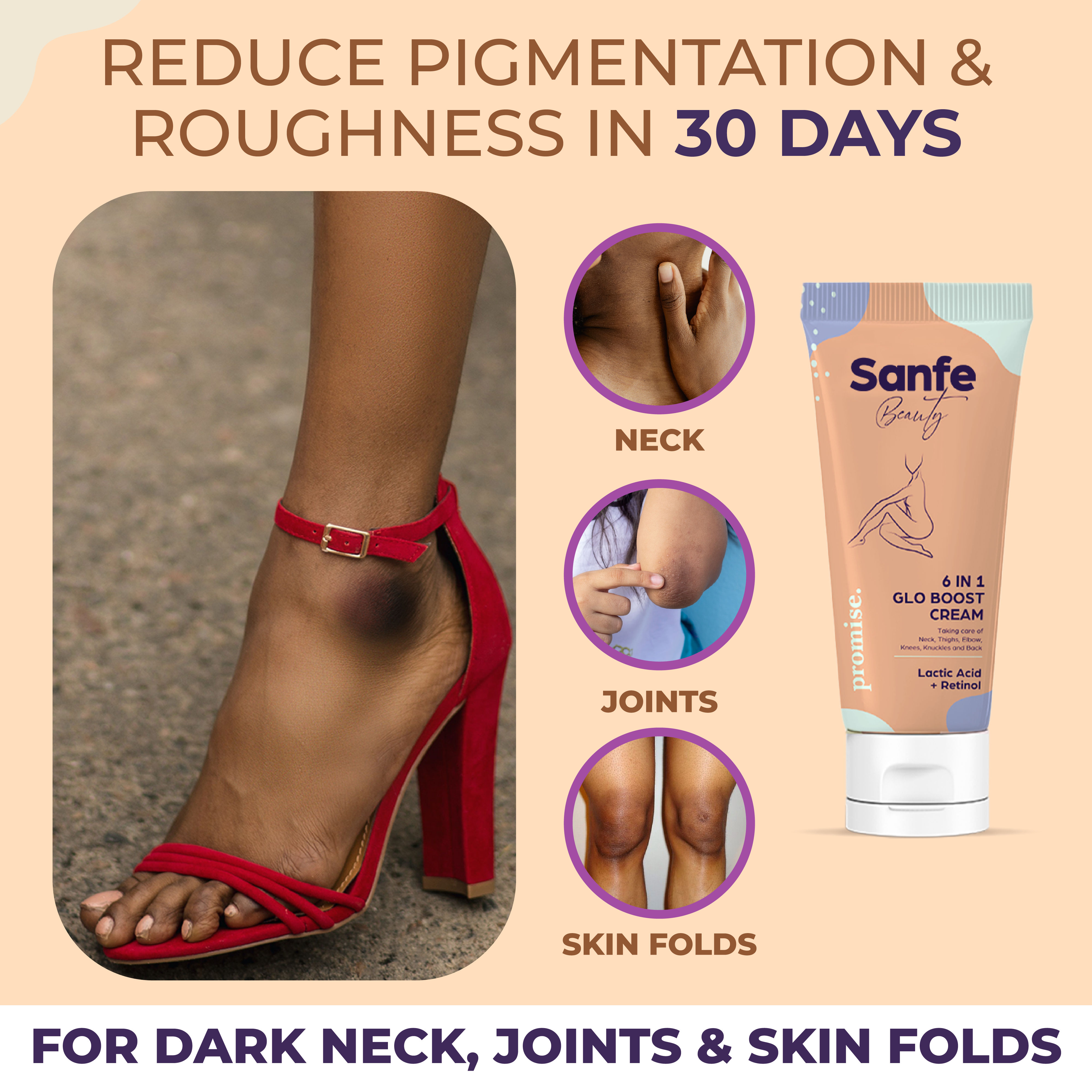 Sanfe Spotlite Body Serum Cream For Dark Neck, Joints and Skinfolds ...