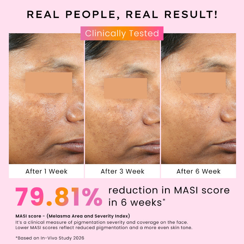 Buy Hyphen Biphasic Advanced De-Pigmentation Serum, Correct & Prevent ...