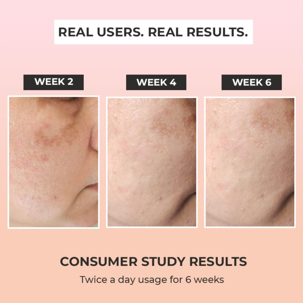 The Pink Foundry Dark Spot & Hyperpigmentation Correcting Power Serum ...