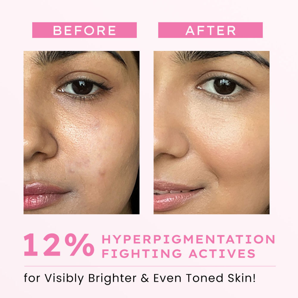 Buy Hyphen Advanced De-Pigmentation Serum Online