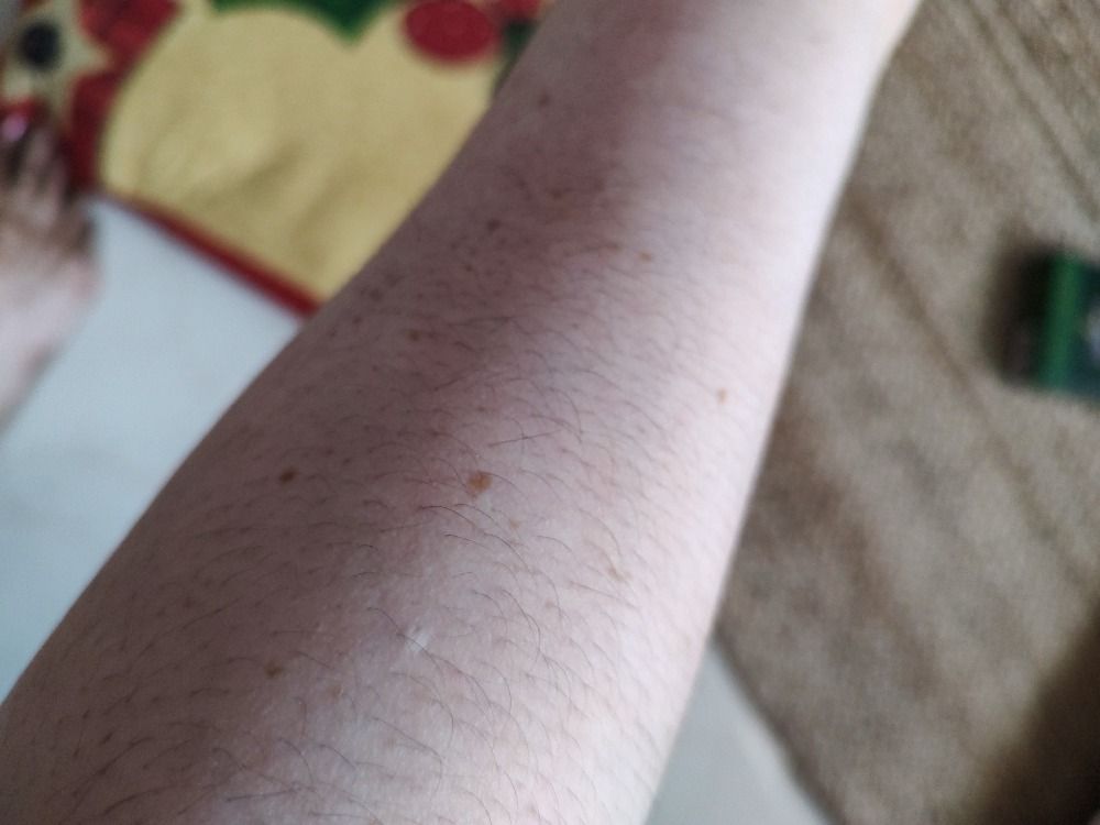 Fixderma Vitipause Gel Reviews Online | Nykaa